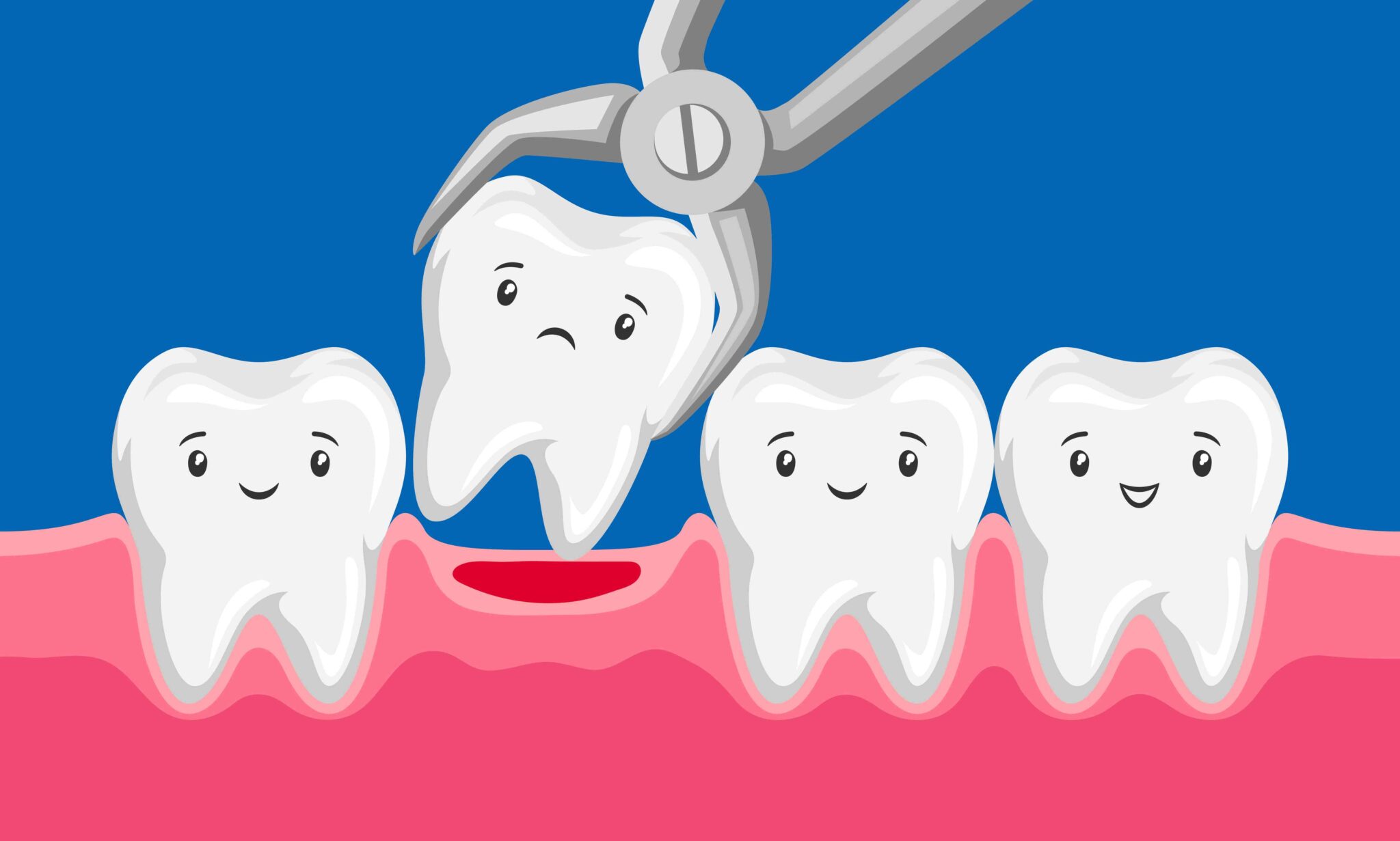 What Do Tooth Extractions Feel Like? Houston | Smiles of Memorial Dentistry